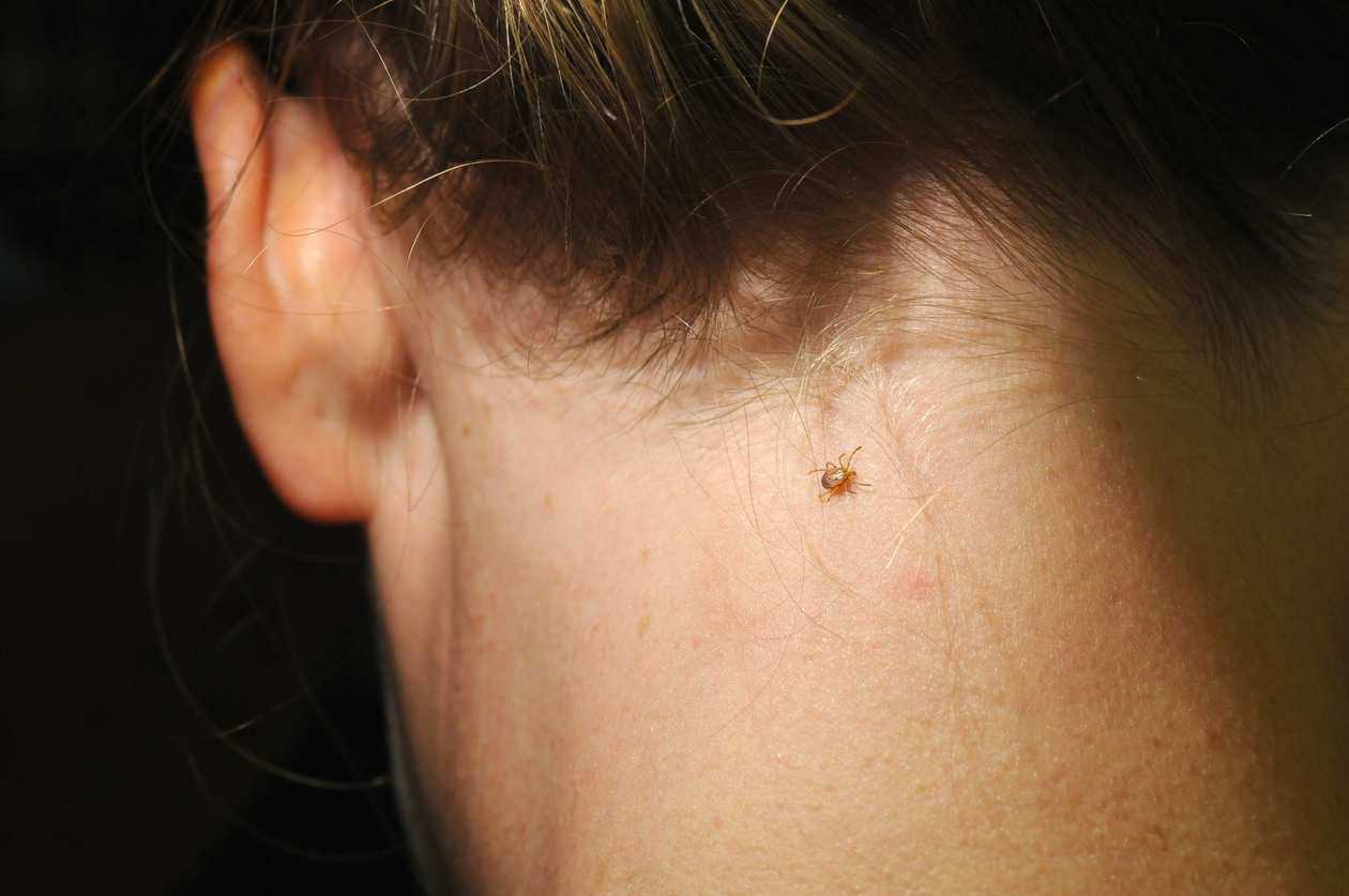 Ticks Spread Plenty More For You To Worry About Beyond Lyme Disease ...